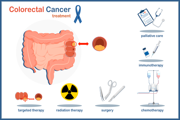 types of bowel cancer surgery