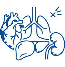 Multiorgan Failure: Symptoms & Care